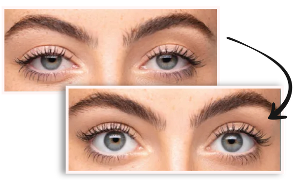 UPNEEQ Sample Box - 10 Vials - Totality Medispa and Skincare